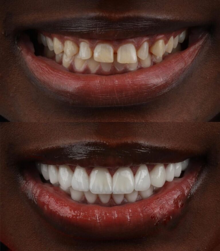 Home - Smile Design Tampa